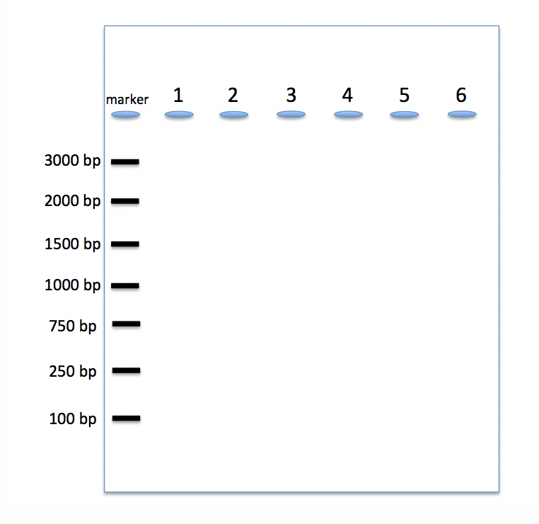 Solved xyl gene | Chegg.com