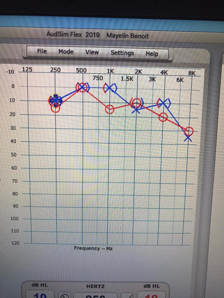 Solved 1) What is the PTA of the audiogram? 2) What are the | Chegg.com