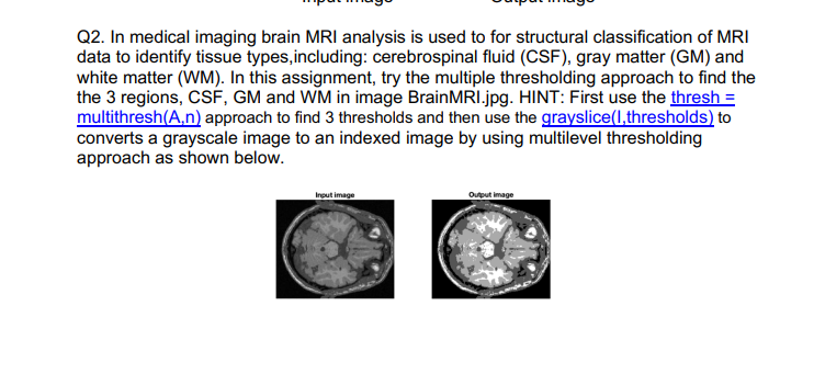 Solved Q2. In medical imaging brain MRI analysis is used to | Chegg.com