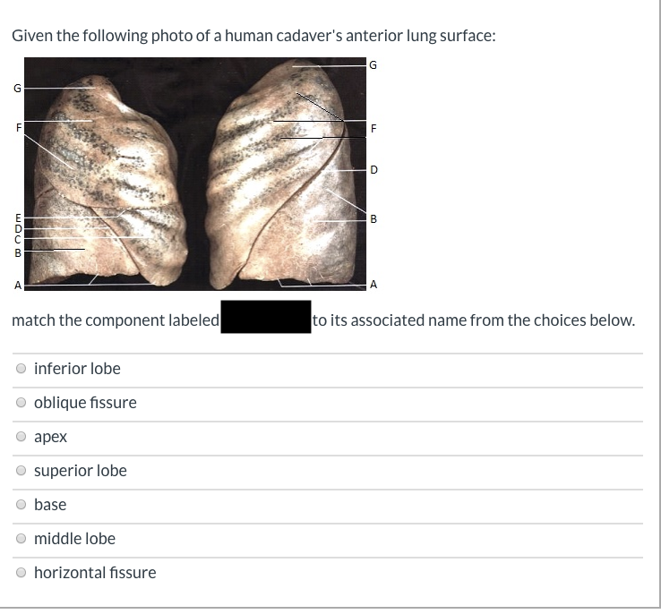 Solved Given The Following Photo Of A Human Cadavers