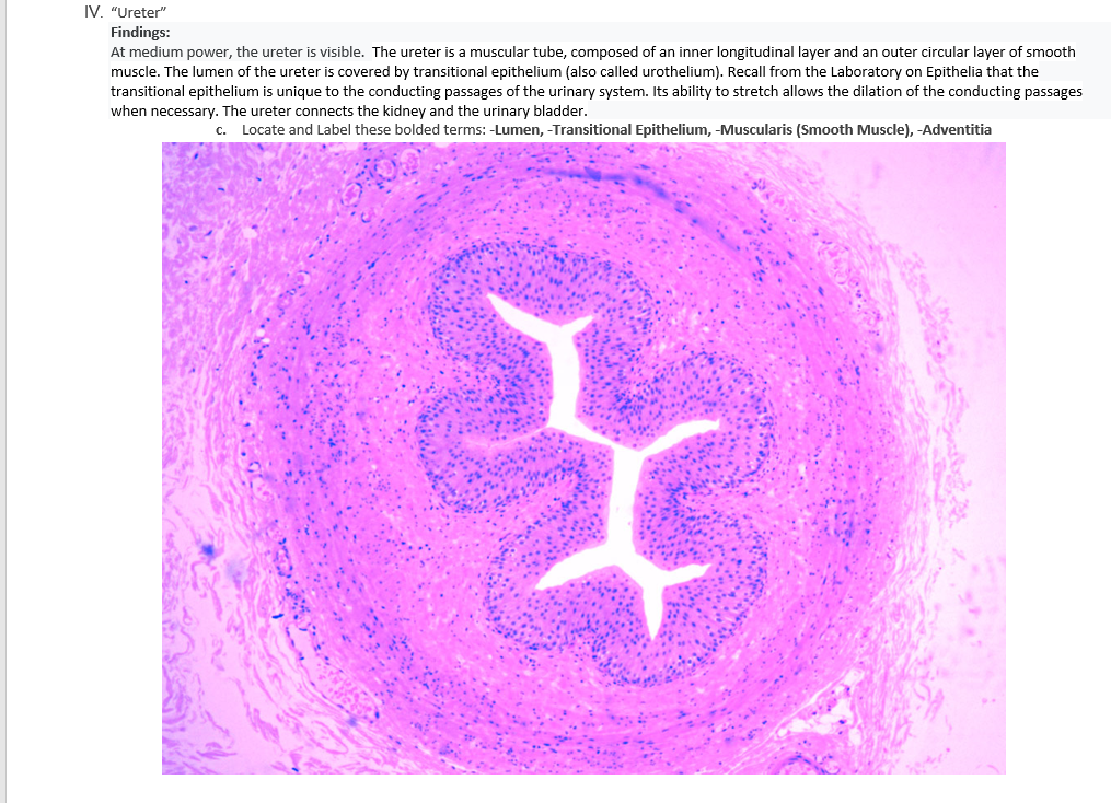 Urinary Bladder Slide Labeled