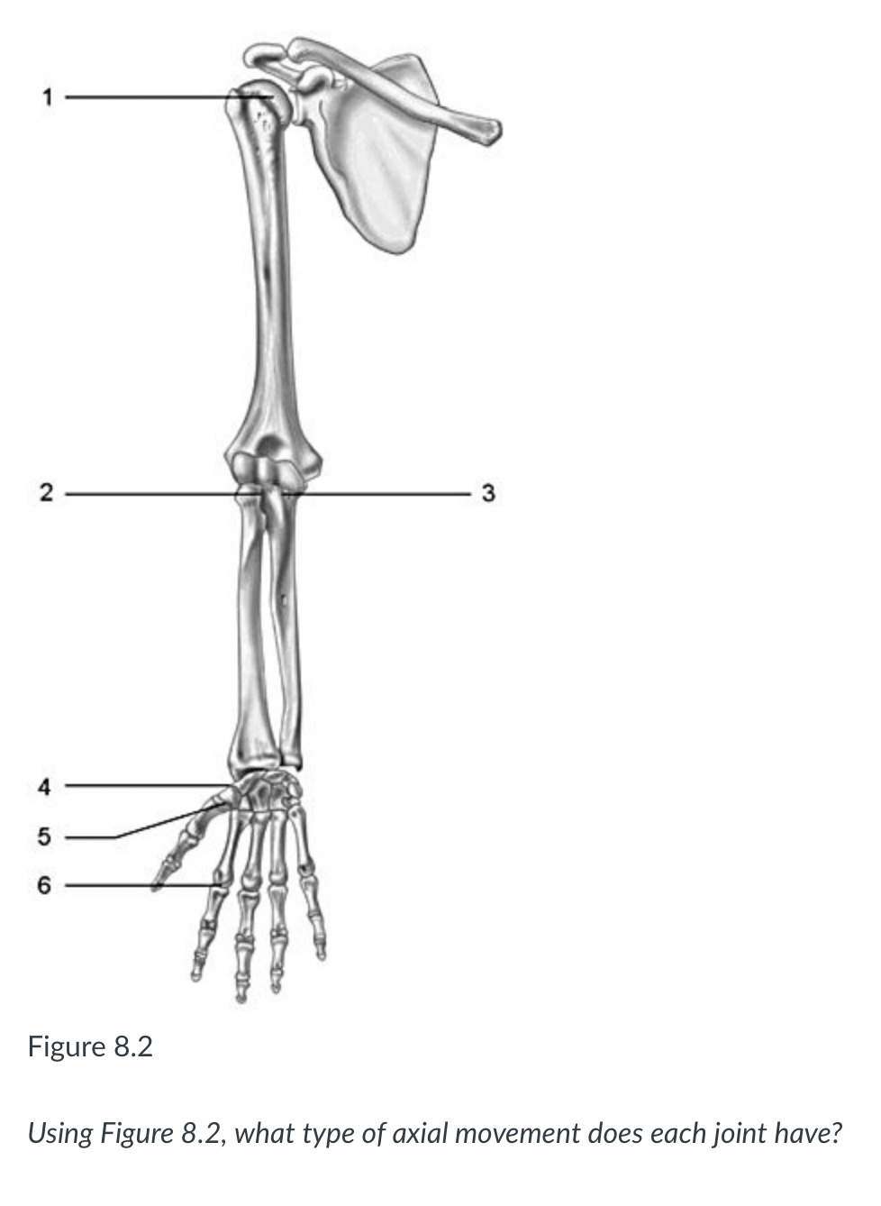 Solved Figure 8.2Using Figure 8.2, ﻿what type of axial | Chegg.com