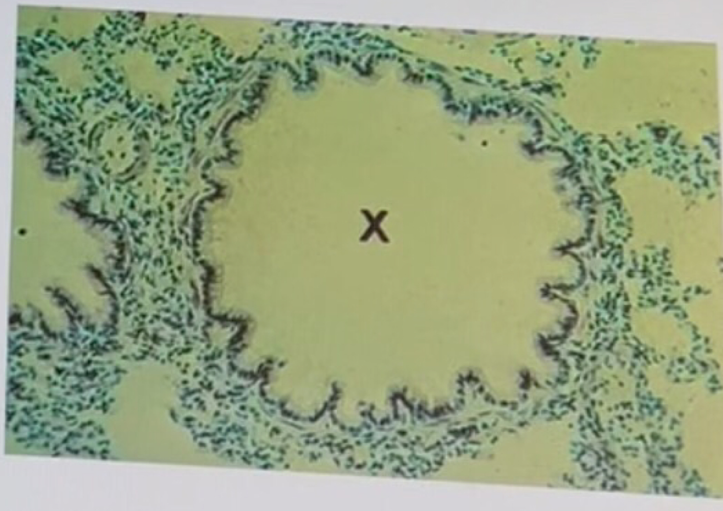 Solved X is in the lumen of an airway shown in the | Chegg.com