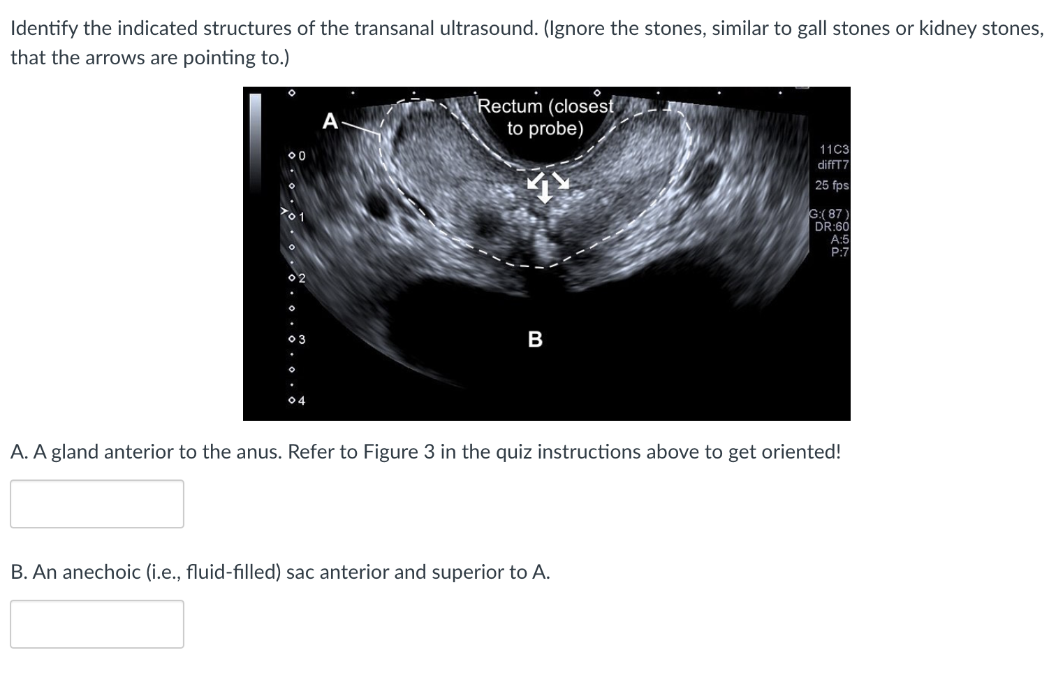 Solved Identify the indicated structures in this sagittal | Chegg.com