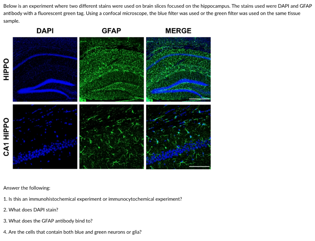 Solved Below is an experiment where two different stains | Chegg.com