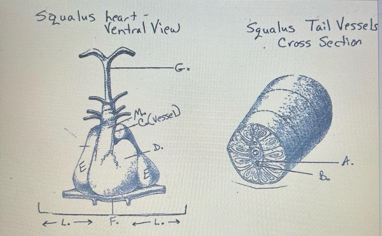 Solved Hi, I need help labeling the veins and arteries for | Chegg.com
