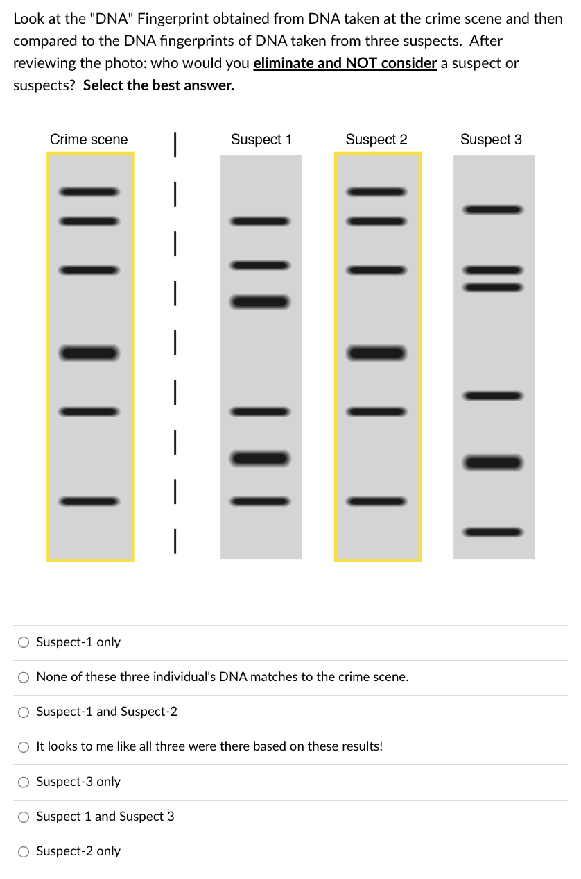 Solved Look at this image of the gel electrophoresis set-up. | Chegg.com