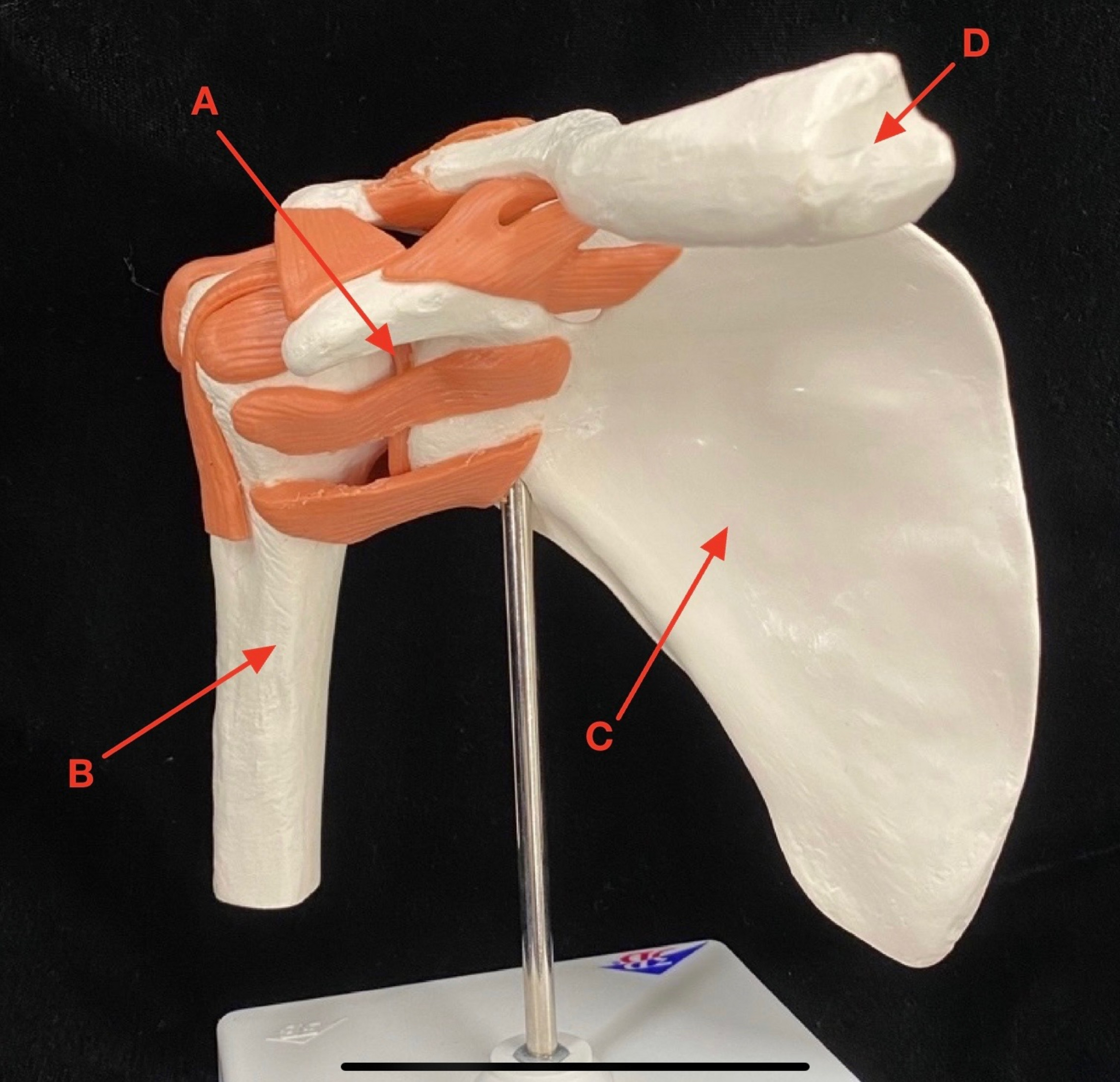 Solved 1-What would be the classification of structure A | Chegg.com