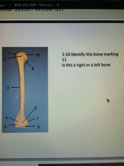Solved Identify this bone marking. Is this a | Chegg.com