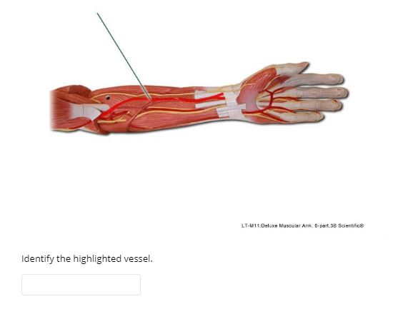 Solved Identify the highlighted vessel Identify the | Chegg.com