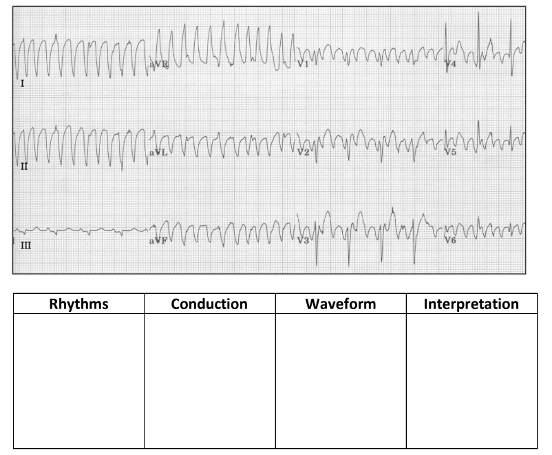 Solved The following use-case is in relation to the ECG | Chegg.com