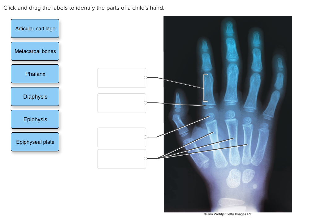 Solved Click and drag the labels to identify the parts of a | Chegg.com