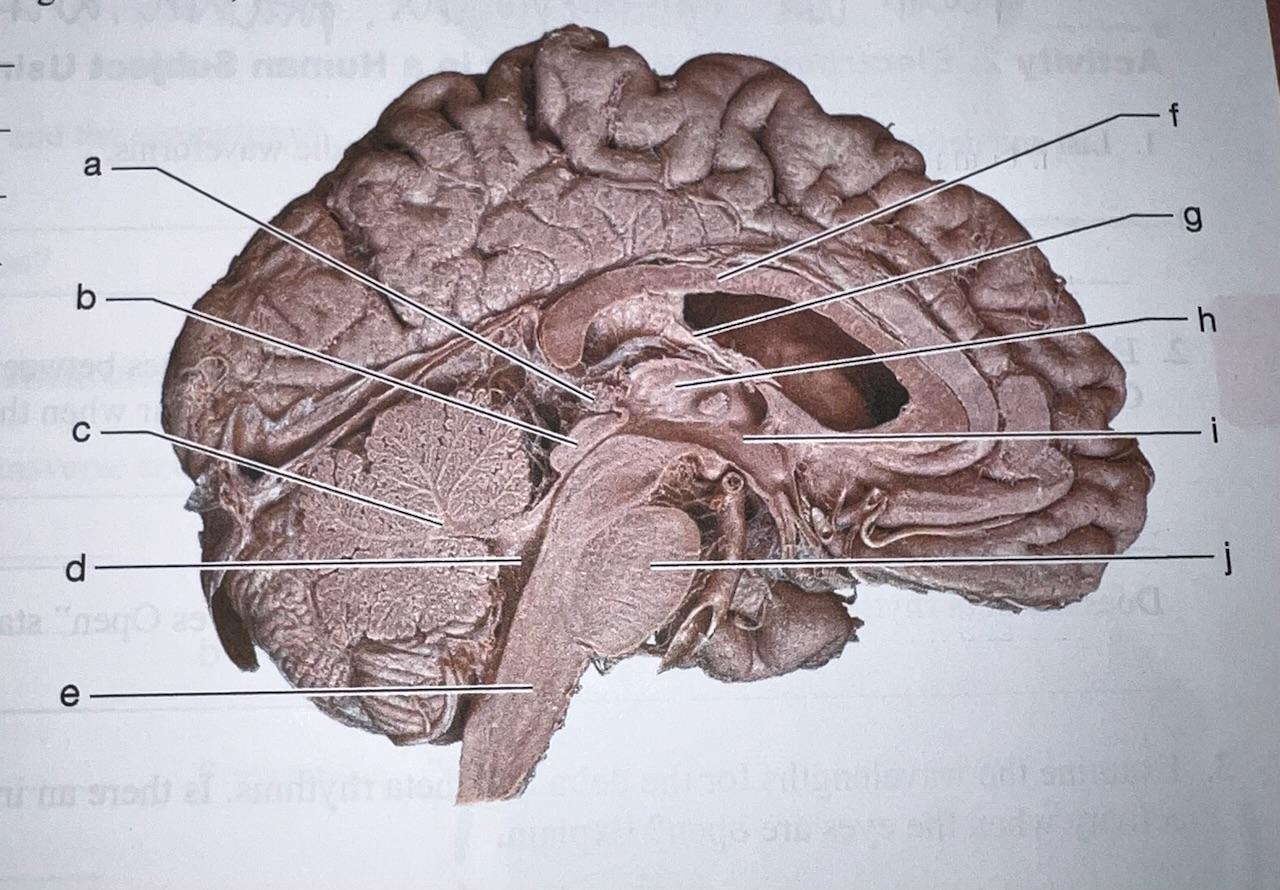 Solved Please identify the components of the brain below. | Chegg.com