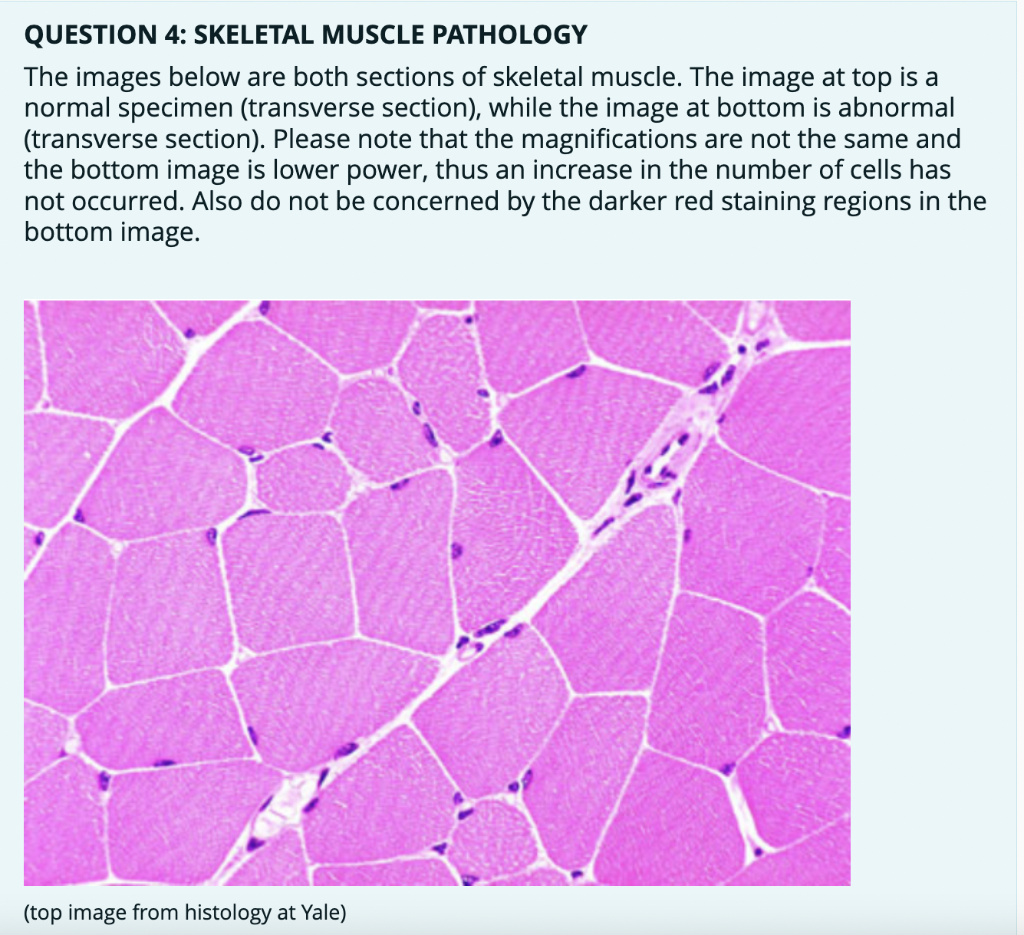 Solved SKELETAL MUSCLE PATHOLOGY The images below are both | Chegg.com