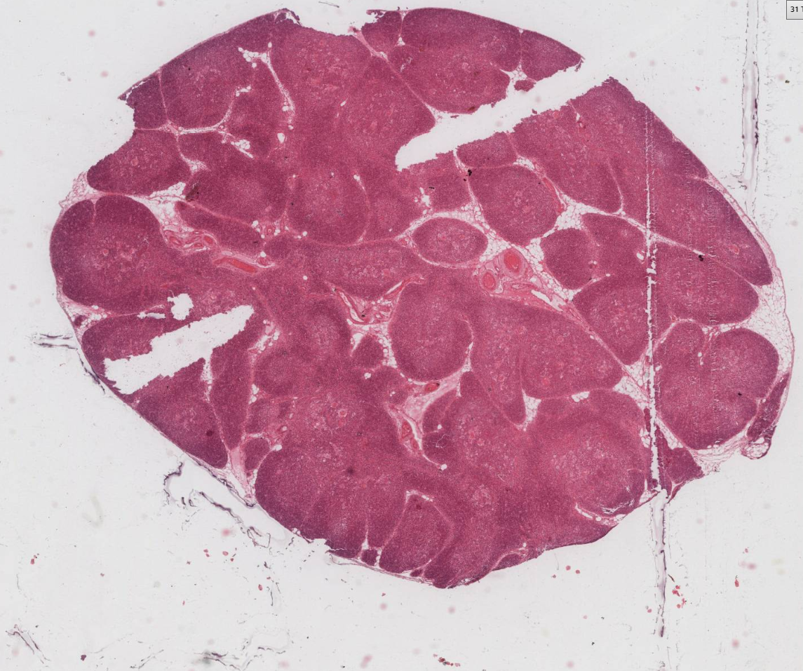 Solved 21. Thymus (i) Describe the microscopic structure of | Chegg.com