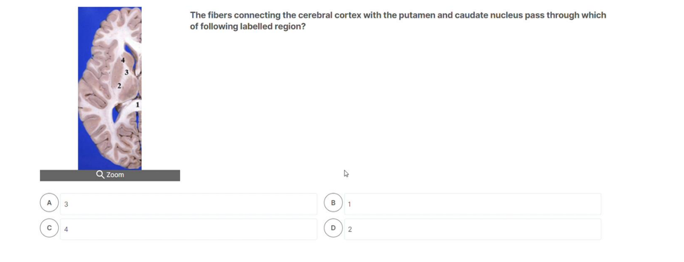 Solved In which of the following labelled regions is the | Chegg.com