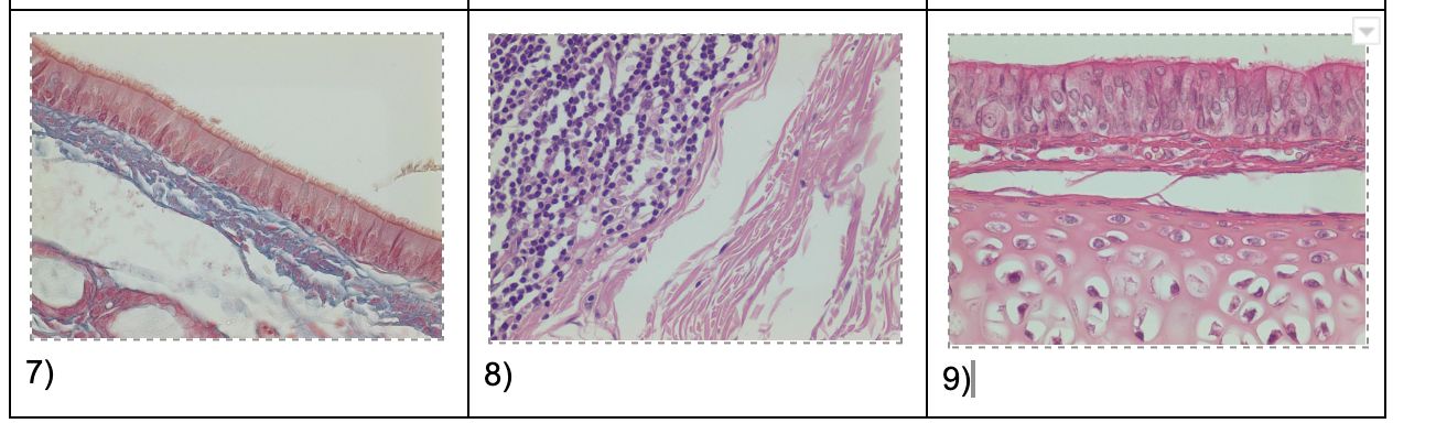 Solved Specificity where is brush border Cilia | Chegg.com