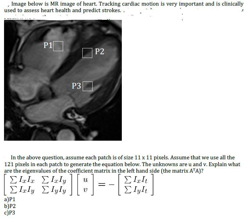 Solved Image below is MR image of heart. Tracking cardiac | Chegg.com