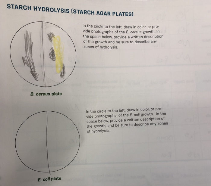 Solved STARCH HYDROLYSIS (STARCH AGAR PLATES) In the circle | Chegg.com