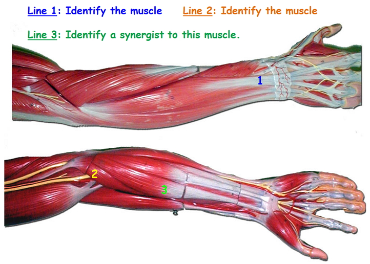 Solved Line 1: Identify the muscle Line 2: Identify the | Chegg.com