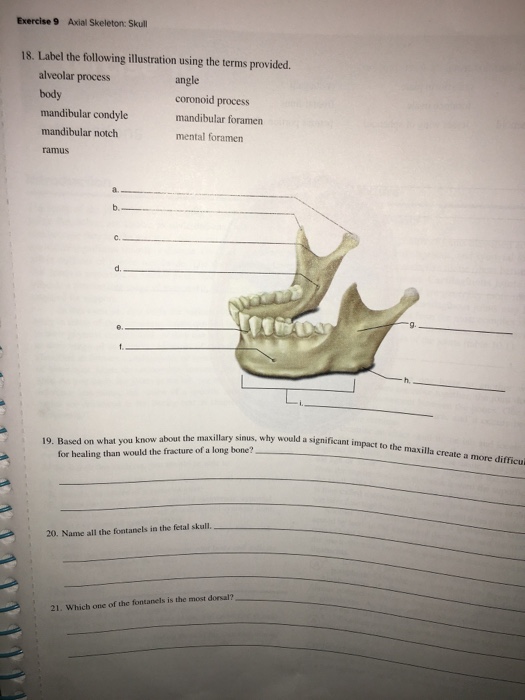 Solved Exercise 9 Axial Skeleton: Skull 18. Label the | Chegg.com