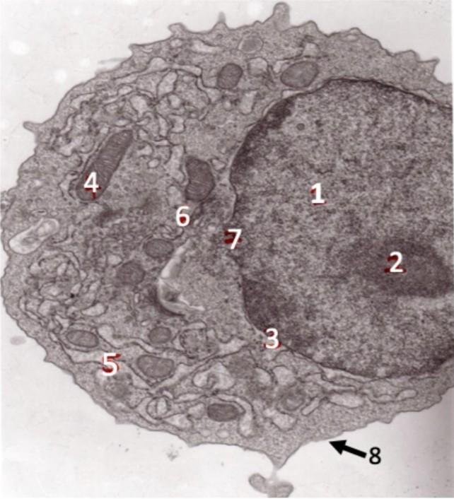 Solved The electron micrograph of a lymphocyte show below | Chegg.com