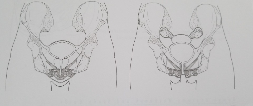Solved Help with regions of the pelvis? Fill in the table | Chegg.com