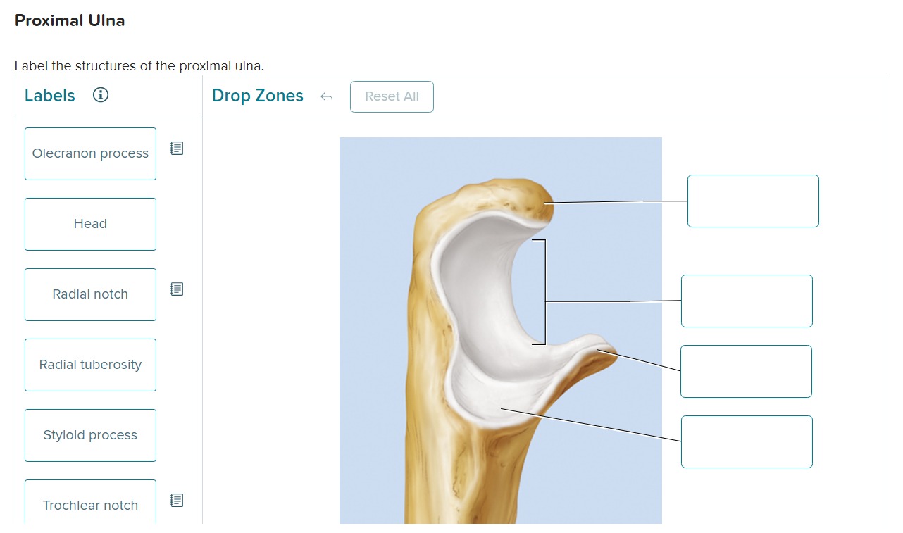 Solved Label the structures of the proximal ulna. | Chegg.com Solved Label the structures of the proximal ulna. | Chegg.com