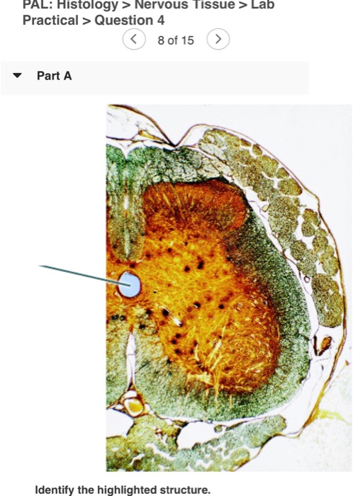 Solved PAL: Histology >Nervous Tissue > Lalb Practical | Chegg.com