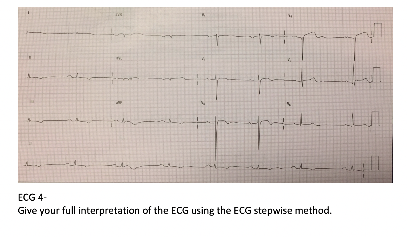 ECG 4- Give your full interpretation of the ECG using | Chegg.com