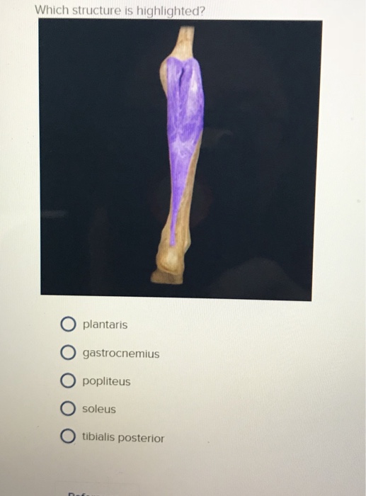 Solved Which structure is highlighted? O rectus abdominis | Chegg.com