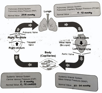 Solved Ideniify the distal and proximal lumens (PAP. CVP. | Chegg.com