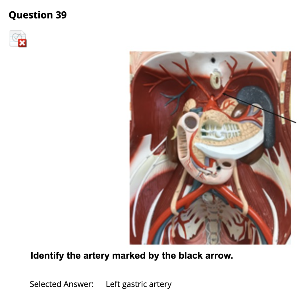 Solved Identify the vein marked by the white arrow. Selected | Chegg.com