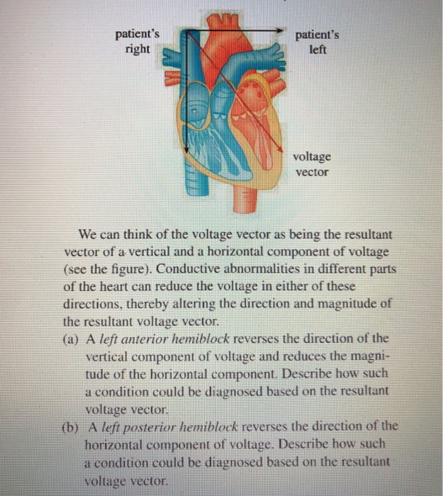 Solved 39. Vectorcardiography As the heart beats it | Chegg.com