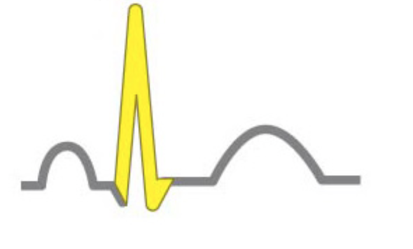 Solved When you observe this phase of the ECG | Chegg.com