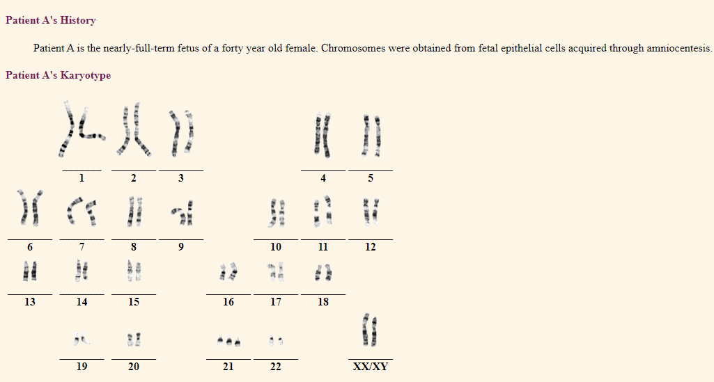 Solved Interpreting the karyotype Lab technicians compile | Chegg.com
