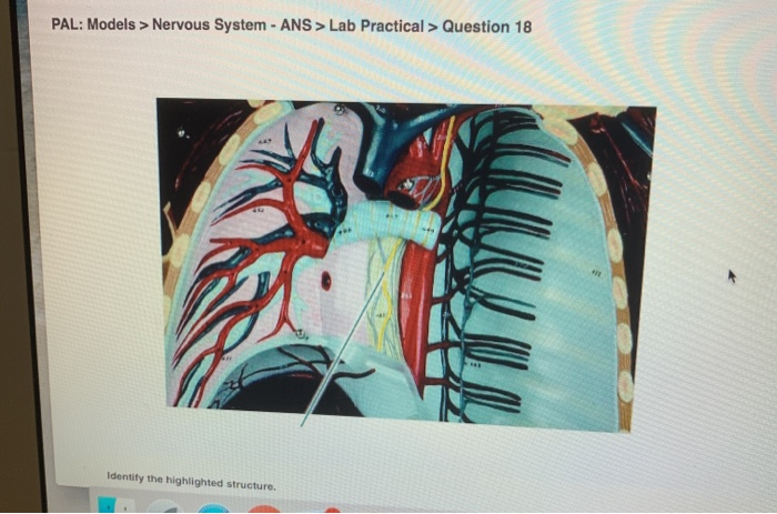 Solved PAL: Models > Nervous System - ANS> Lab Practical > | Chegg.com