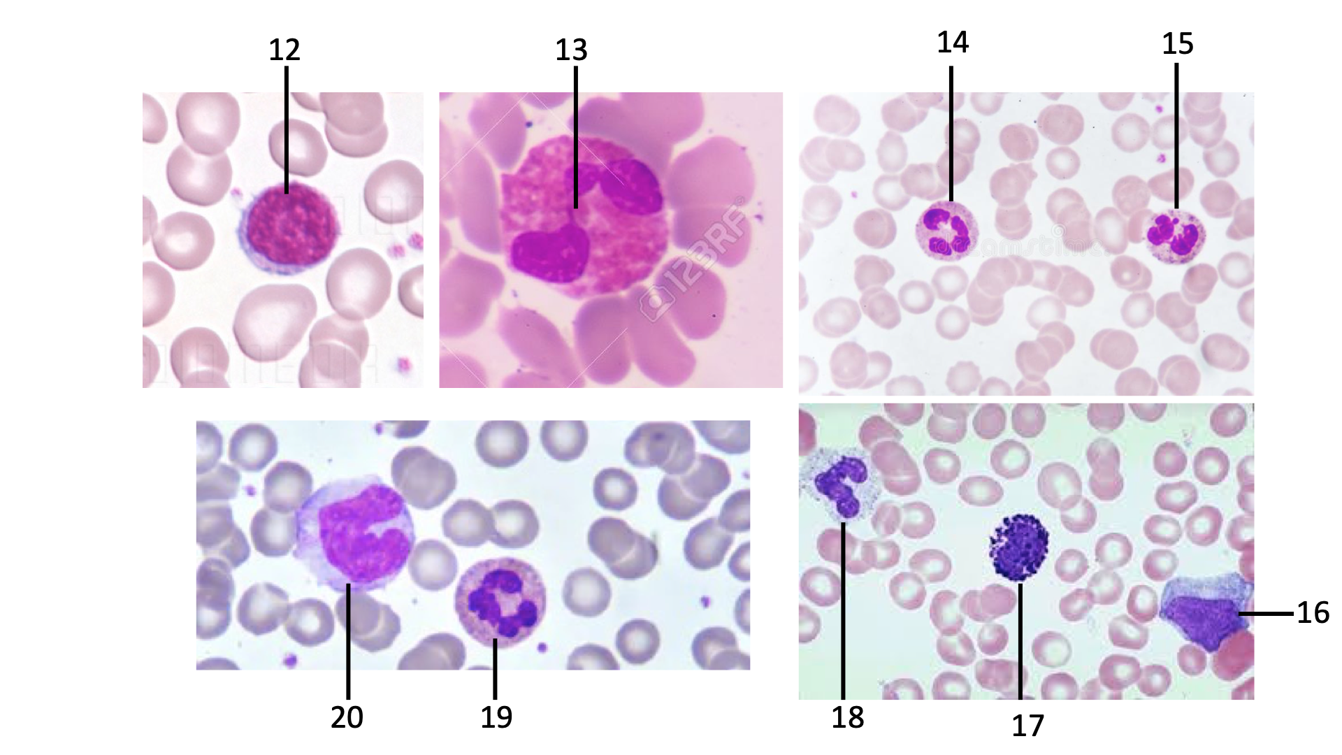 Solved Directions: Identify leukocytes 1-20 by placing your | Chegg.com