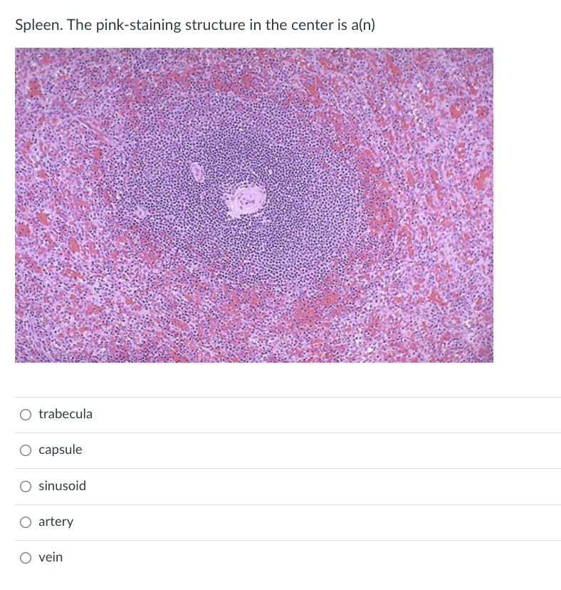 Solved Spleen. The pink-staining structure in the center is | Chegg.com