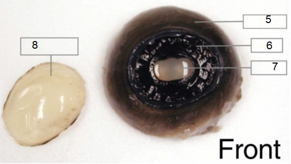 Solved Please Label the dissected eye in a document with | Chegg.com