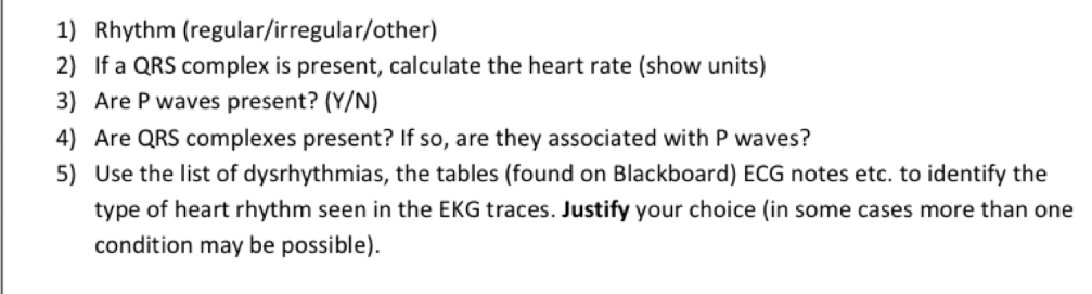 Solved 1) Rhythm (regular/irregular/other) 2) If a QRS | Chegg.com