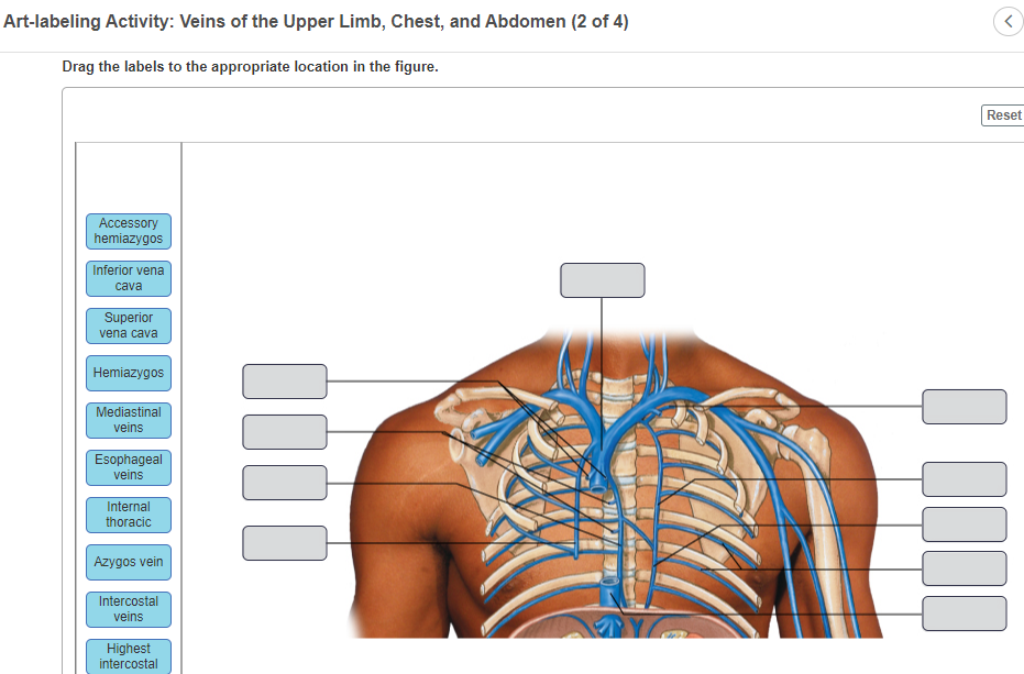 Solved Art-labeling Activity: Arteries of the Chest and | Chegg.com