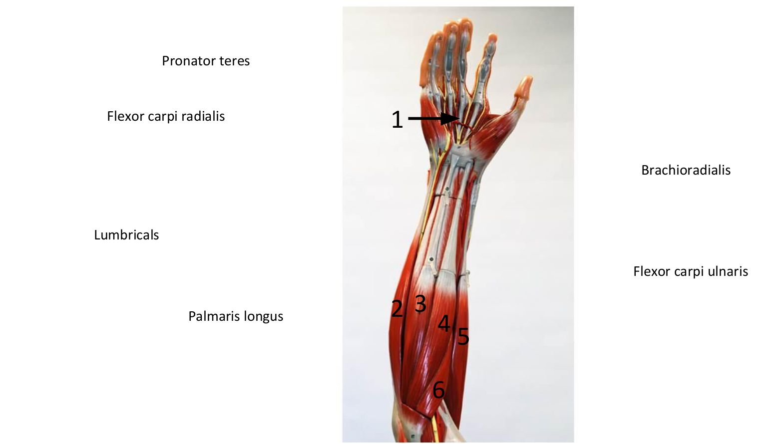 Pronator teres Flexor carpi radialis 1 | Chegg.com