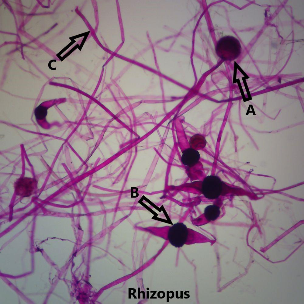 Solved Look at the micrograph of Rhizopus below. Match the | Chegg.com