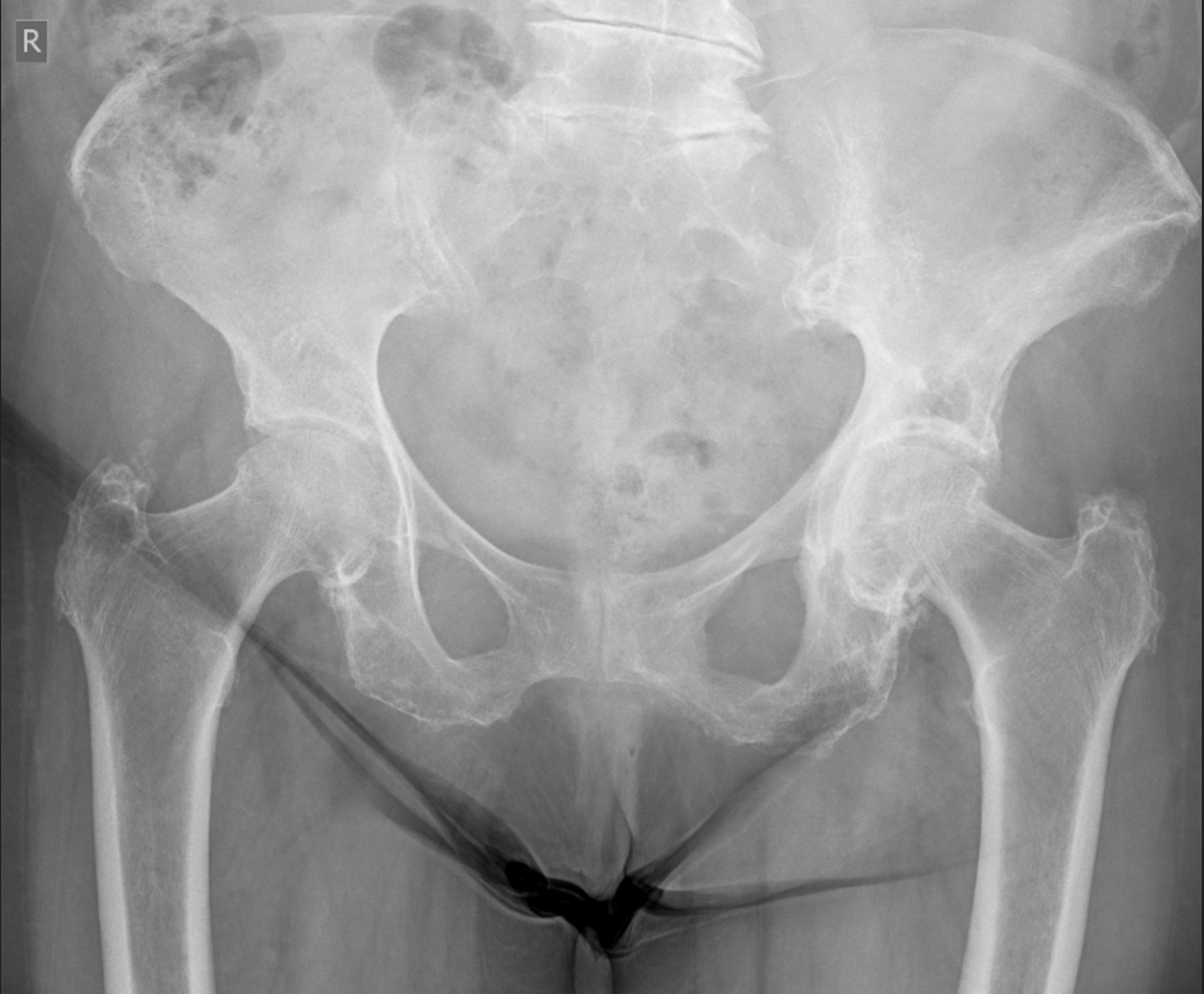 solved-please-identify-what-is-abnormal-and-normal-with-chegg
