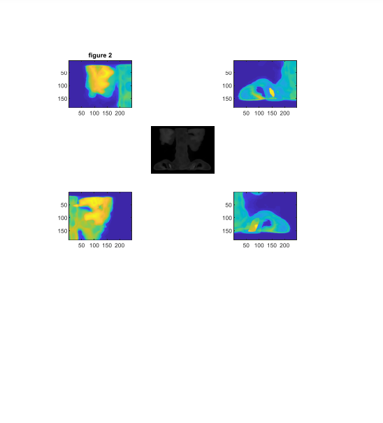 Question 4. Load the image spine.tif from MATLAB. And | Chegg.com