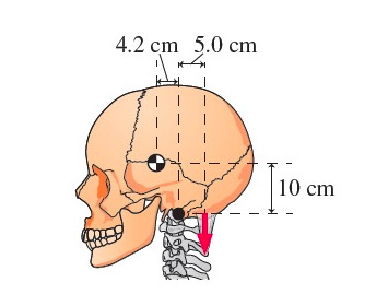 Solved The main muscles that hold your head upright attach | Chegg.com