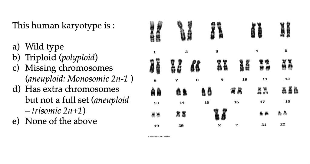 Solved This human karyotype is : 2 3 6 7 8 9 18 11 12 a) | Chegg.com