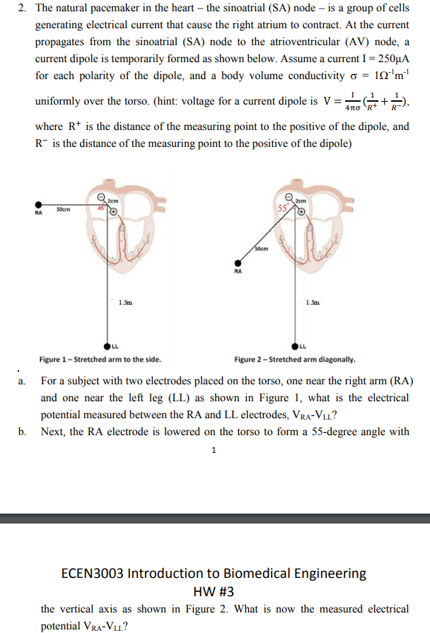 Solved The natural pacemaker in the heart - the sinoatrial | Chegg.com