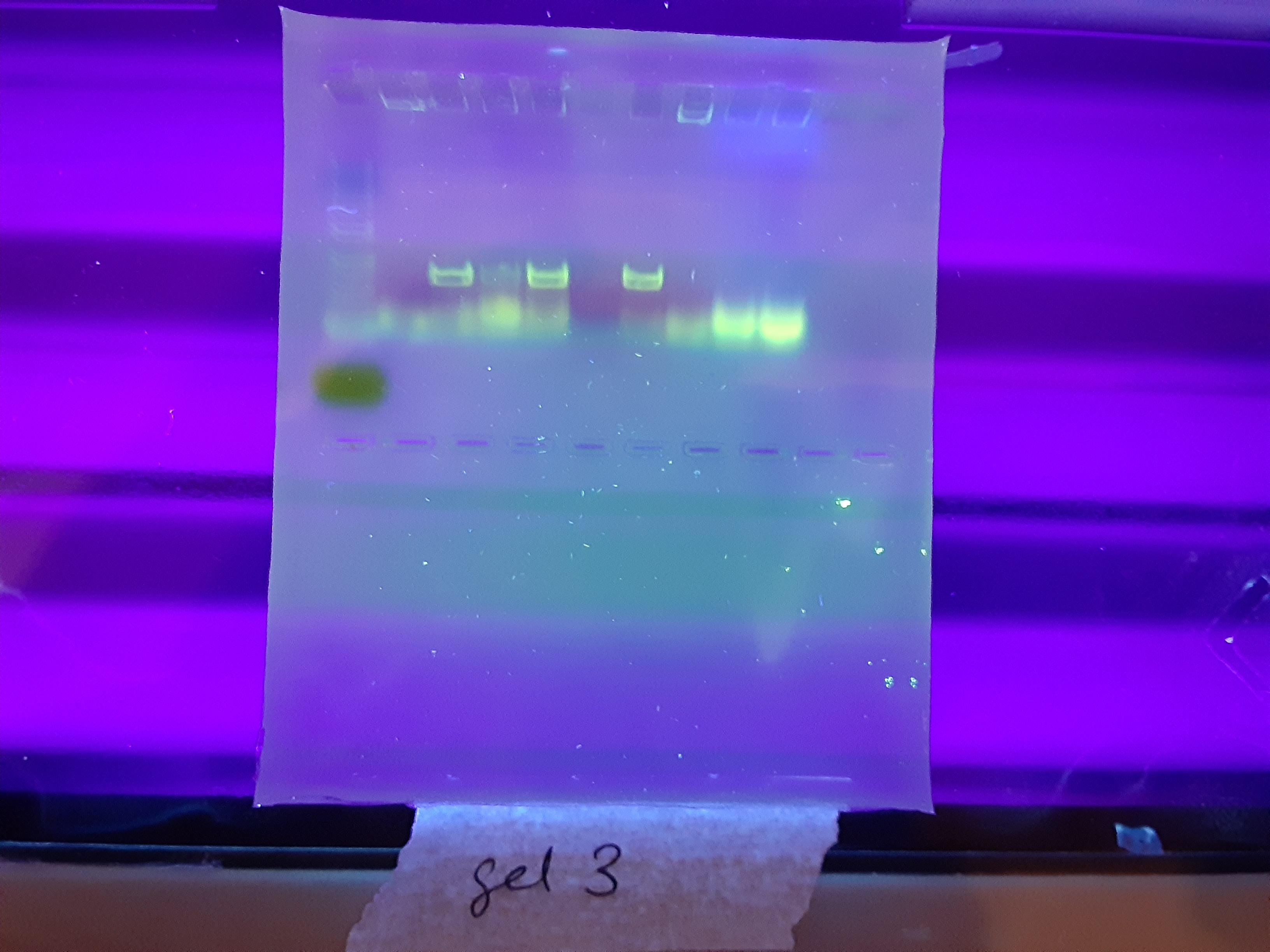 Document your agarose gel observations with a picture | Chegg.com
